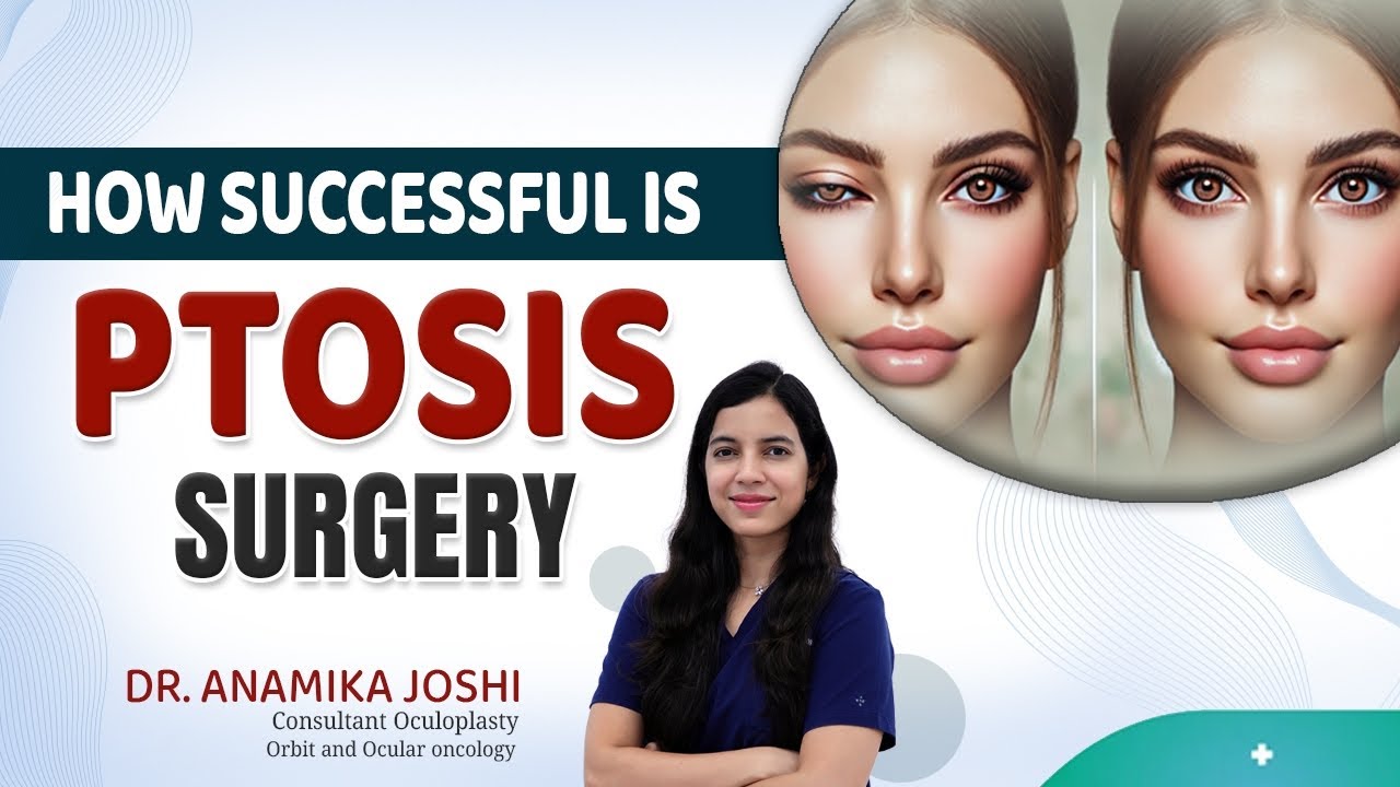 How successful is PTOSIS SURGERY? Explained by an eye plastic surgeon | Ptosis | Dr Anamika ...