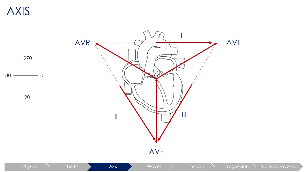 Advanced Pediatric EKGs - YouTube