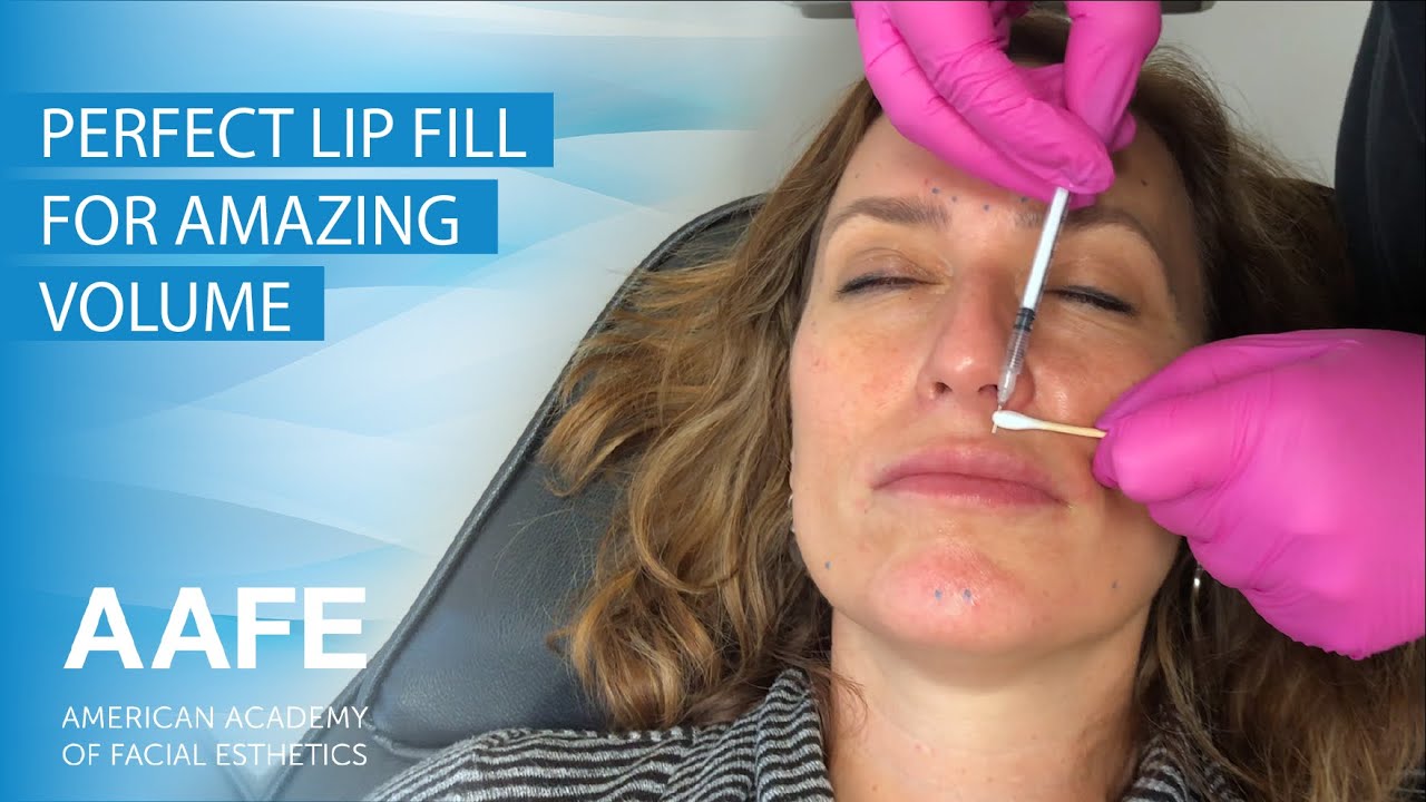 Perfect Lip Fill for Amazing Volume - YouTube