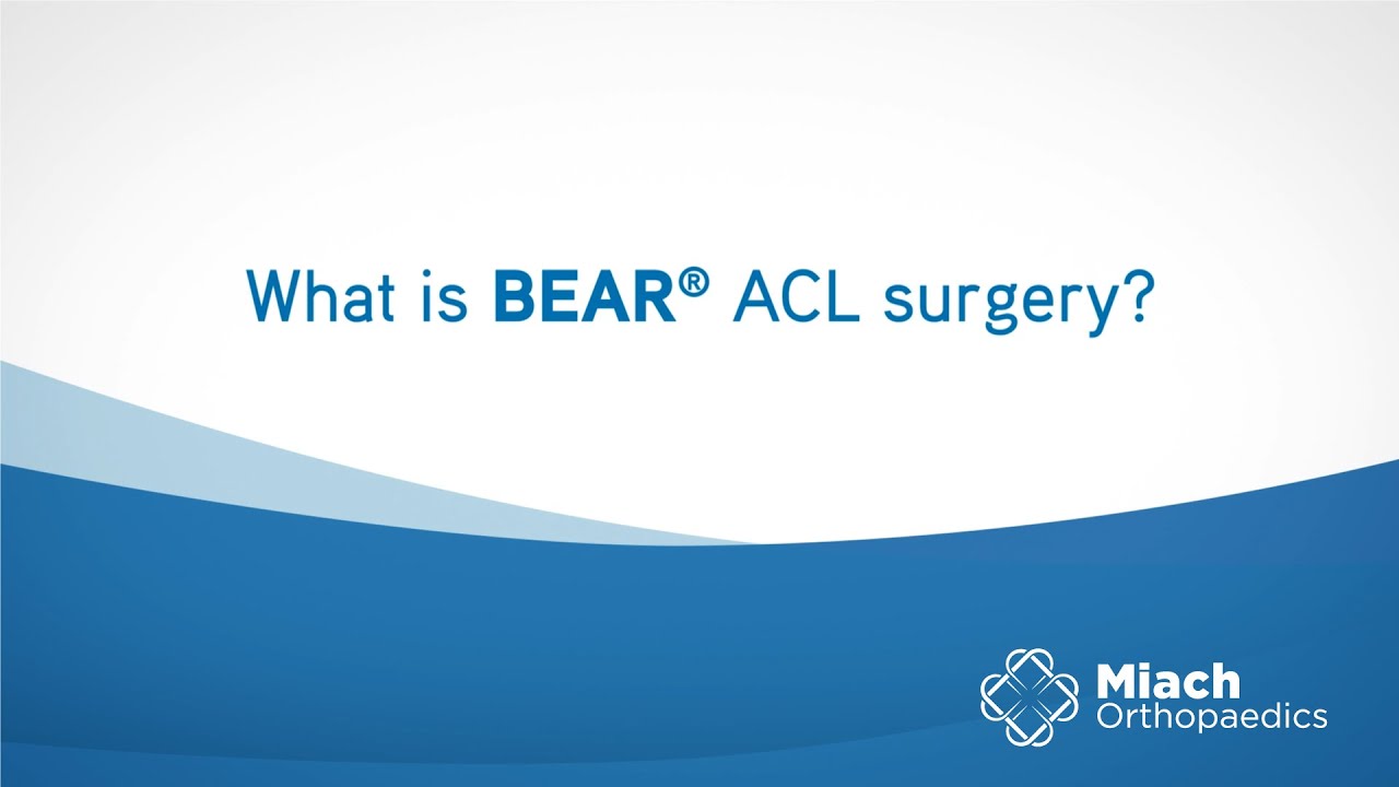 What is BEAR ACL Surgery? | Q&A | Dr. Shawn Anthony | Miach ...