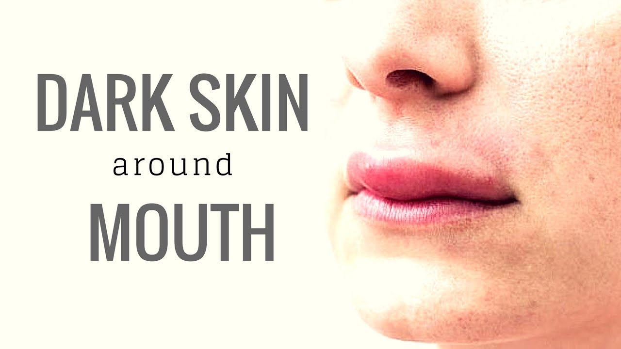 How To Get Rid Of Dark Skin Around Mouth Remove Dark Patches Around how-to-get-rid-of-dark-skin-around-mouth-remove-dark-patches-around
