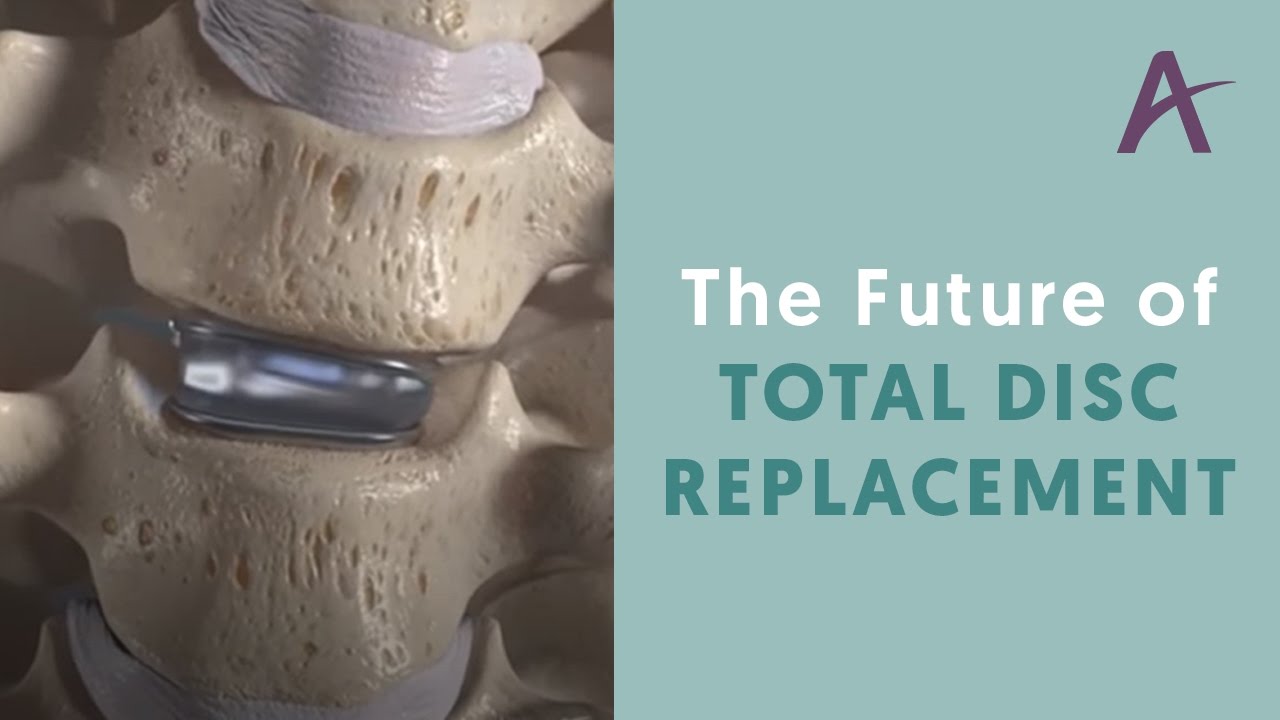 The Future of Total Disc Replacement (TDR) with Jake Lubinski ...