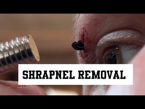 The Full Shrapnel Saga - YouTube