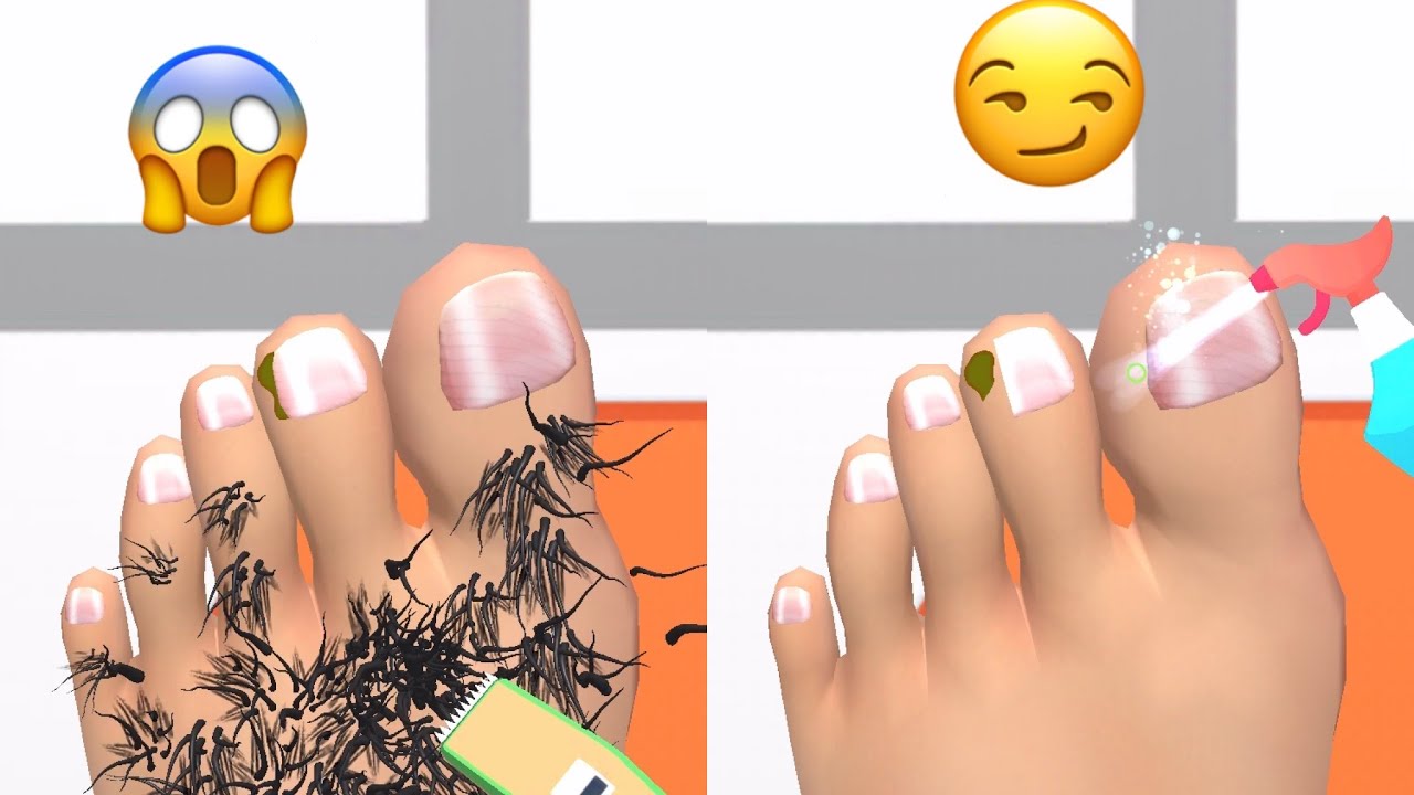 Foot Clinic ASMR Feet Care Game | Max New Level | Mobile Gameplay ...