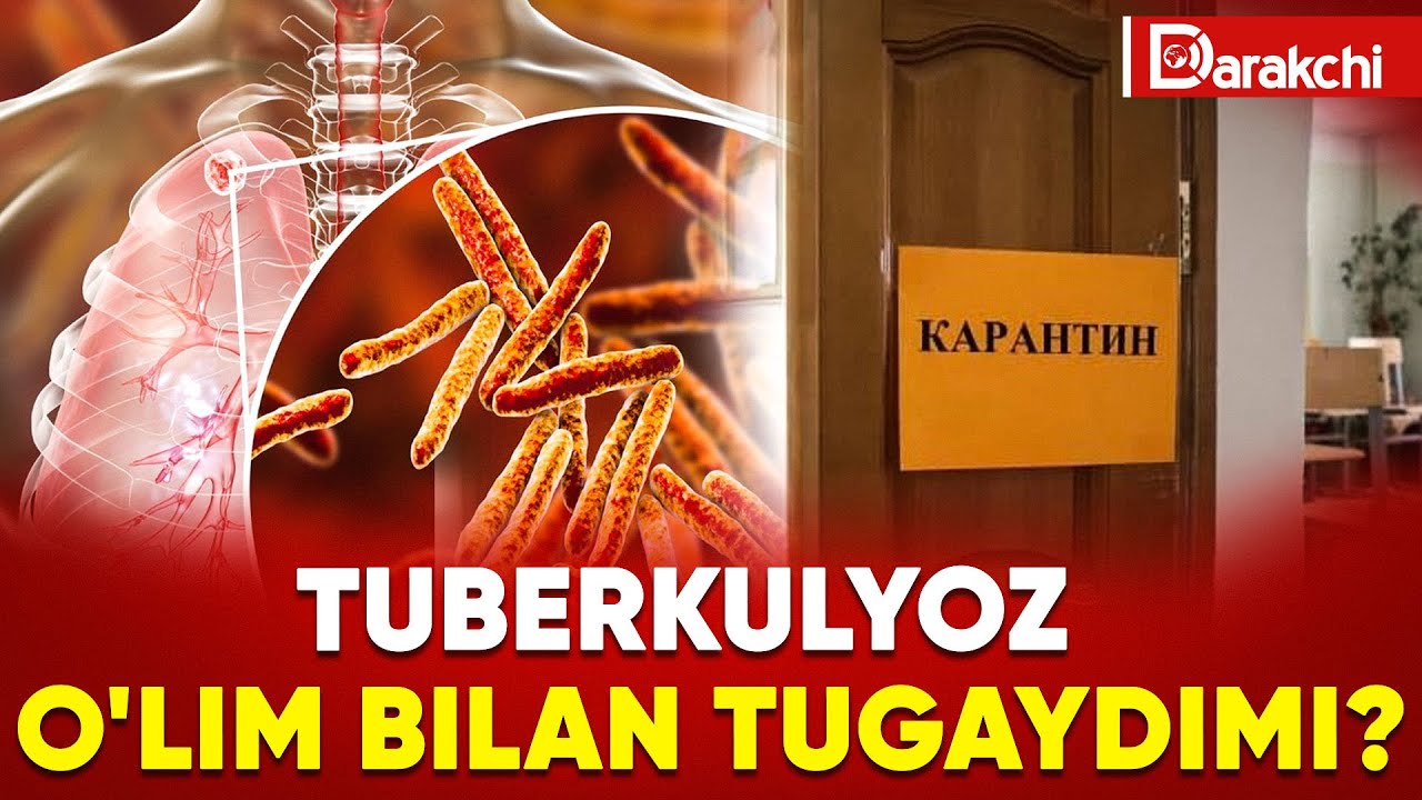 TUBERKULYOZ O'LIM BILAN TUGAYDIMI? - YouTube