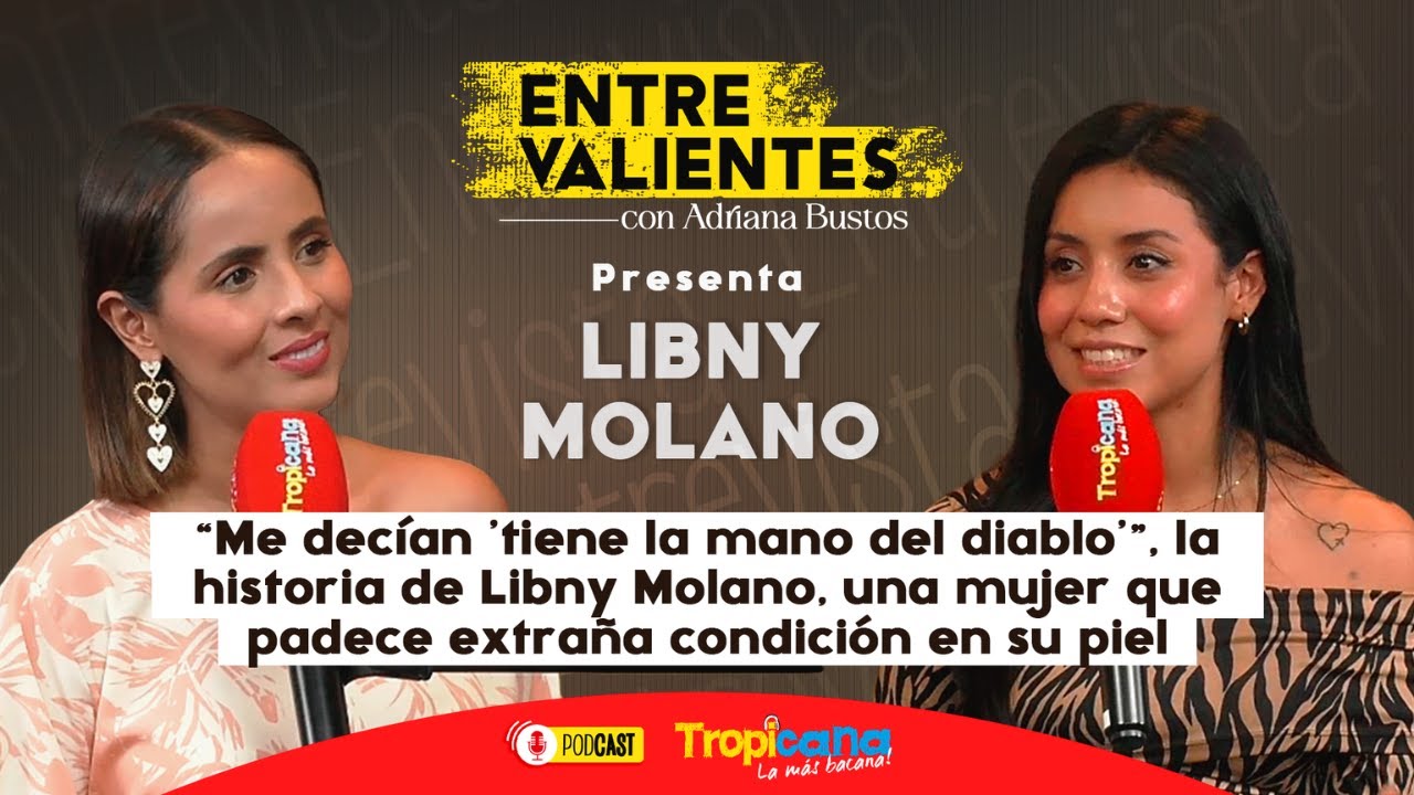 Libny Molano: Venció el bullying por sus más de 200 lunares gracias a ...