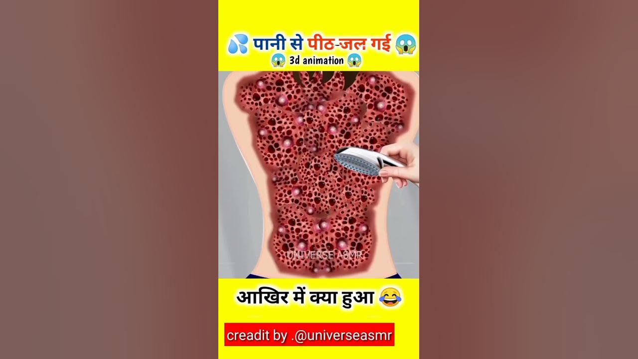 Pith Jal Gai 😱🤯shortvideo Asmr Youtbeshorts Cartoon Youtube