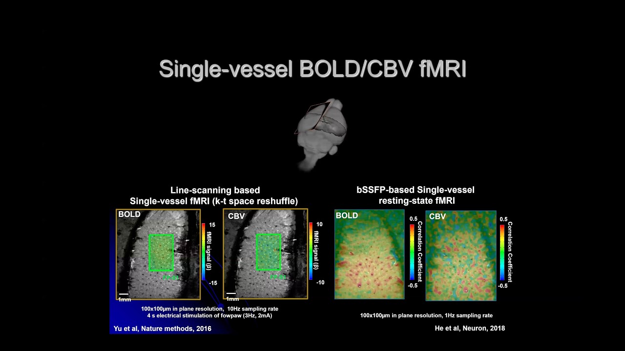 BrainMap: Preclinical high field fMRI at 14 Tesla/Hybrid Wireless ...