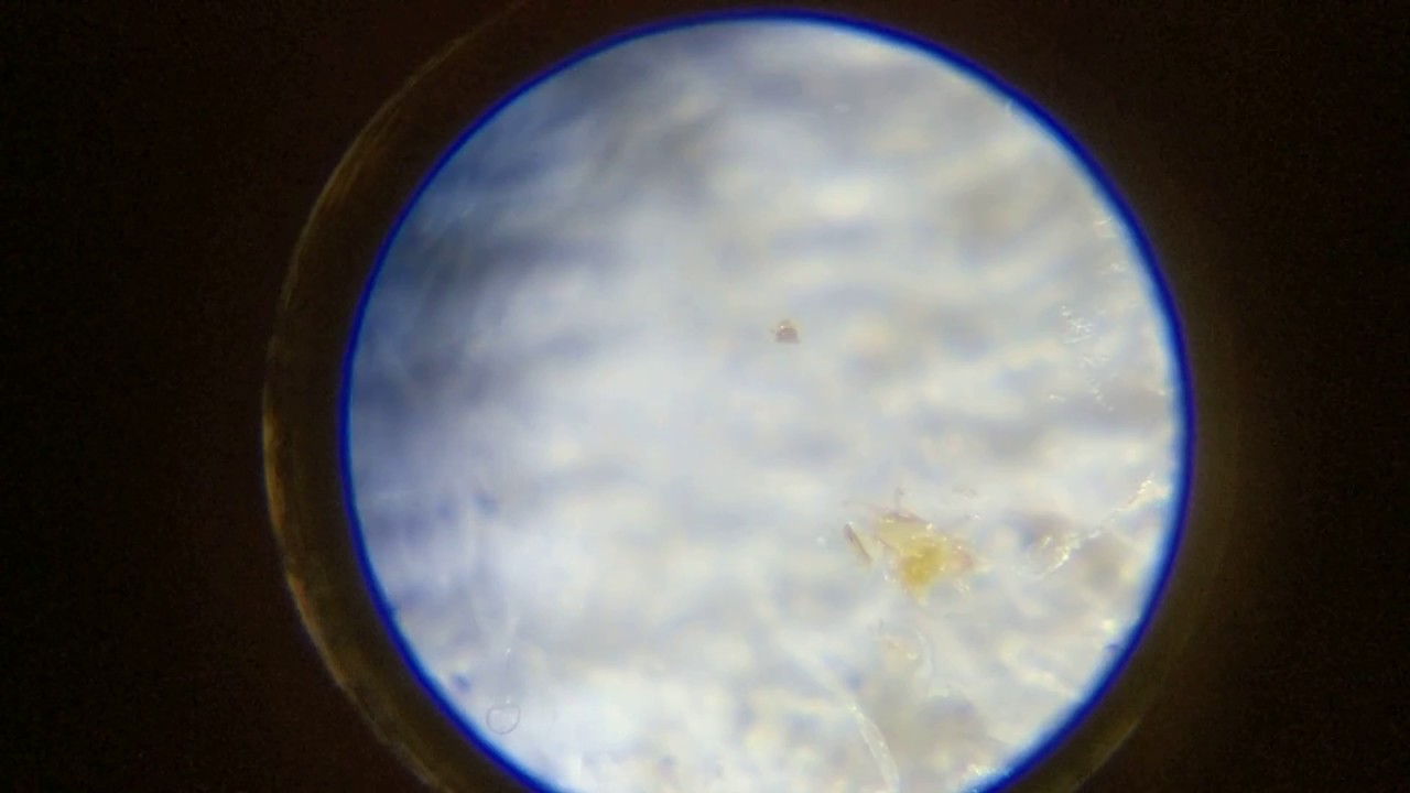 Species of Pyemotes mite - YouTube