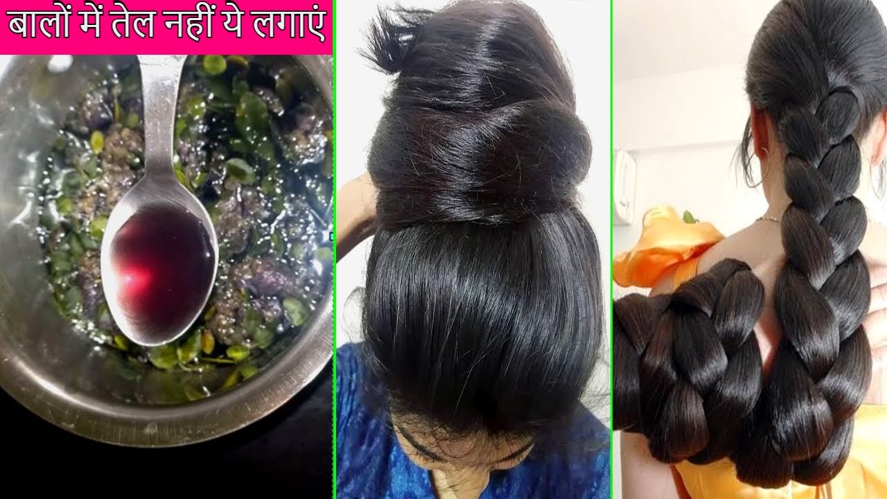 I applied👆🏼World's Fastest Hair Growth Mix on my Bald Scalp for Double ...