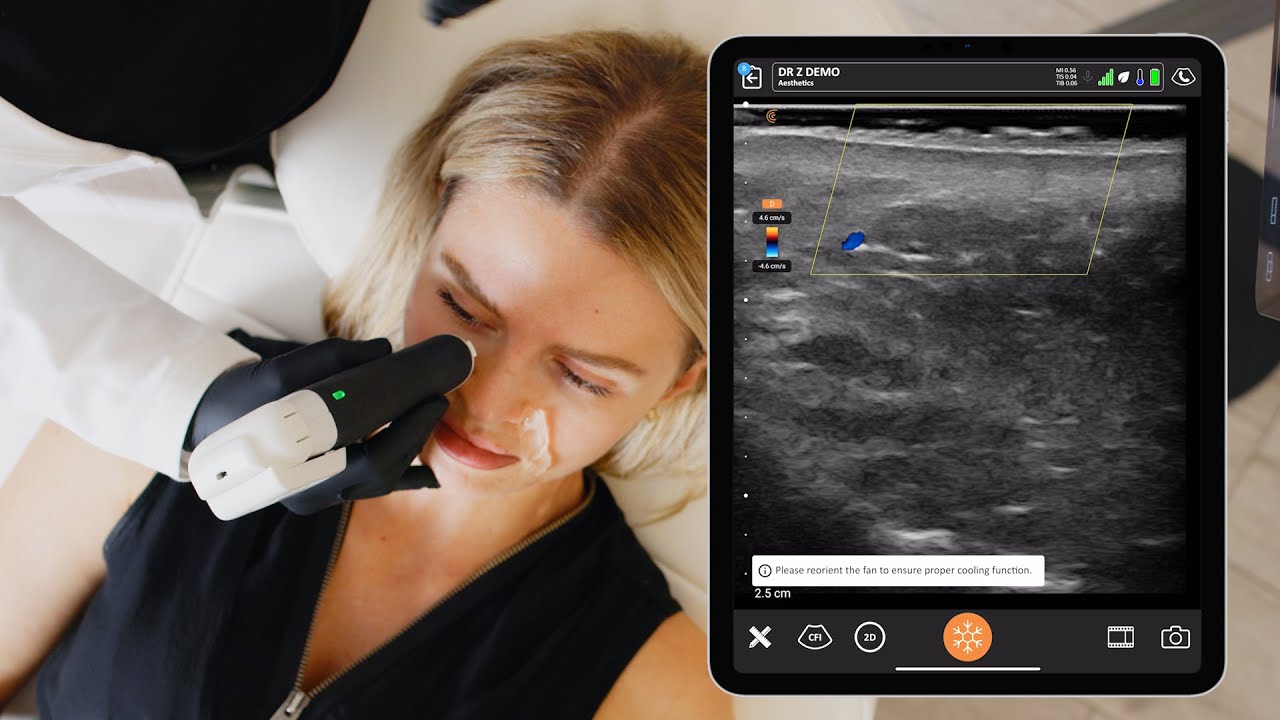 Pyriform Fossa Mapping and Injections - YouTube