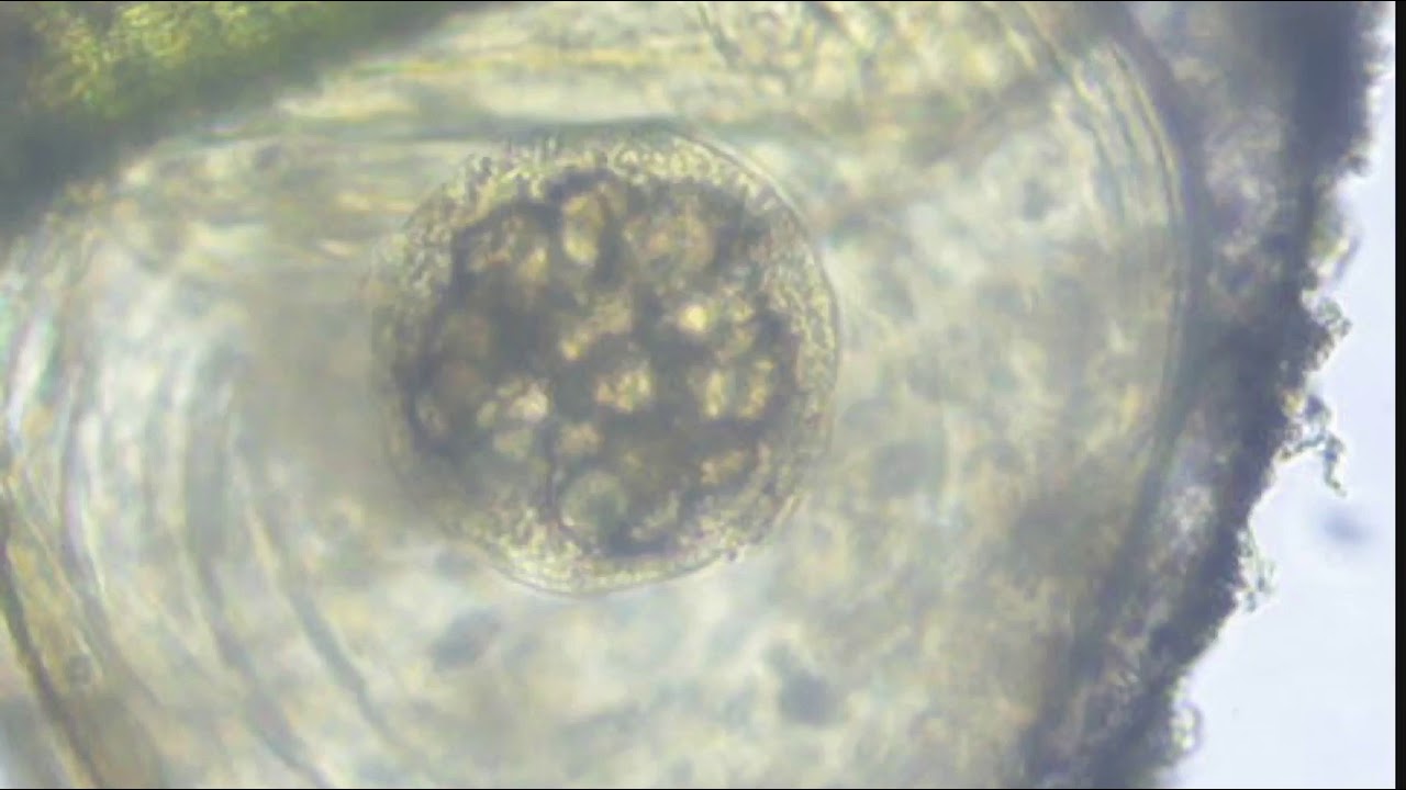 MICROSCOPY - Eggs - YouTube