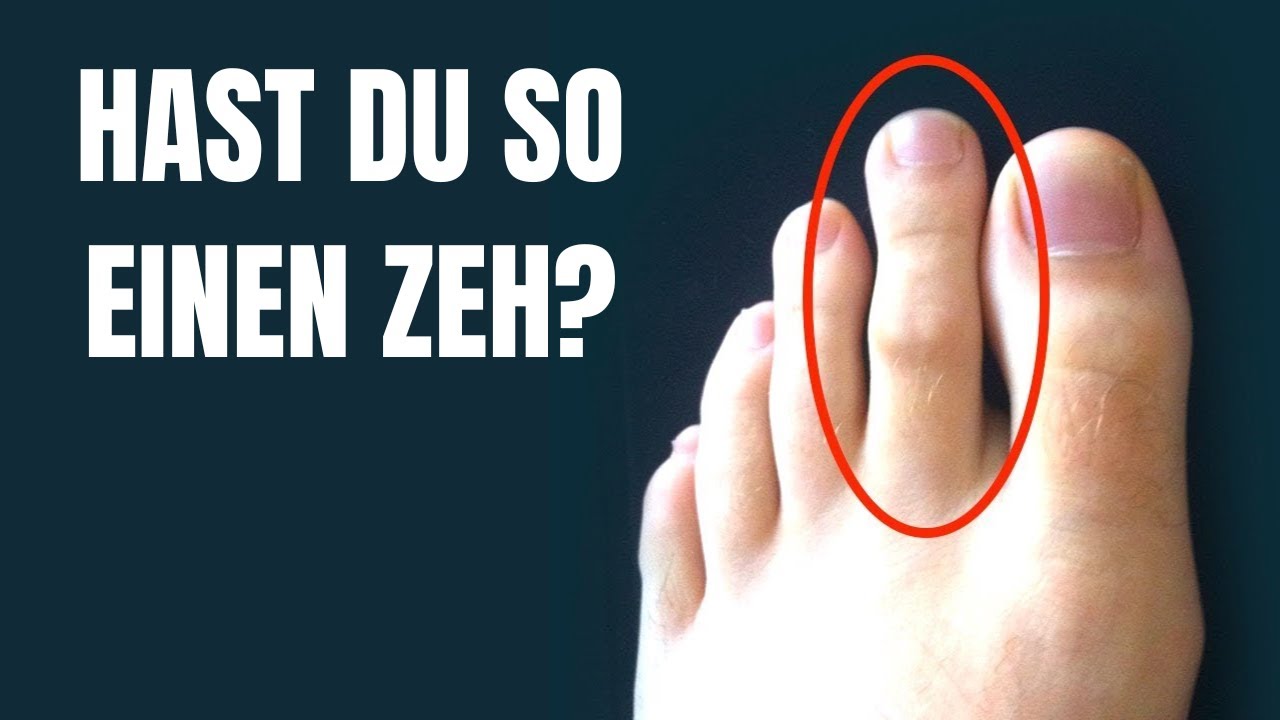 Du hast so einen langen Zeh？ - YouTube