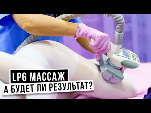 LPG массаж. Эффективное средство или плацебо? Все про ЛПГ массаж | Да ...