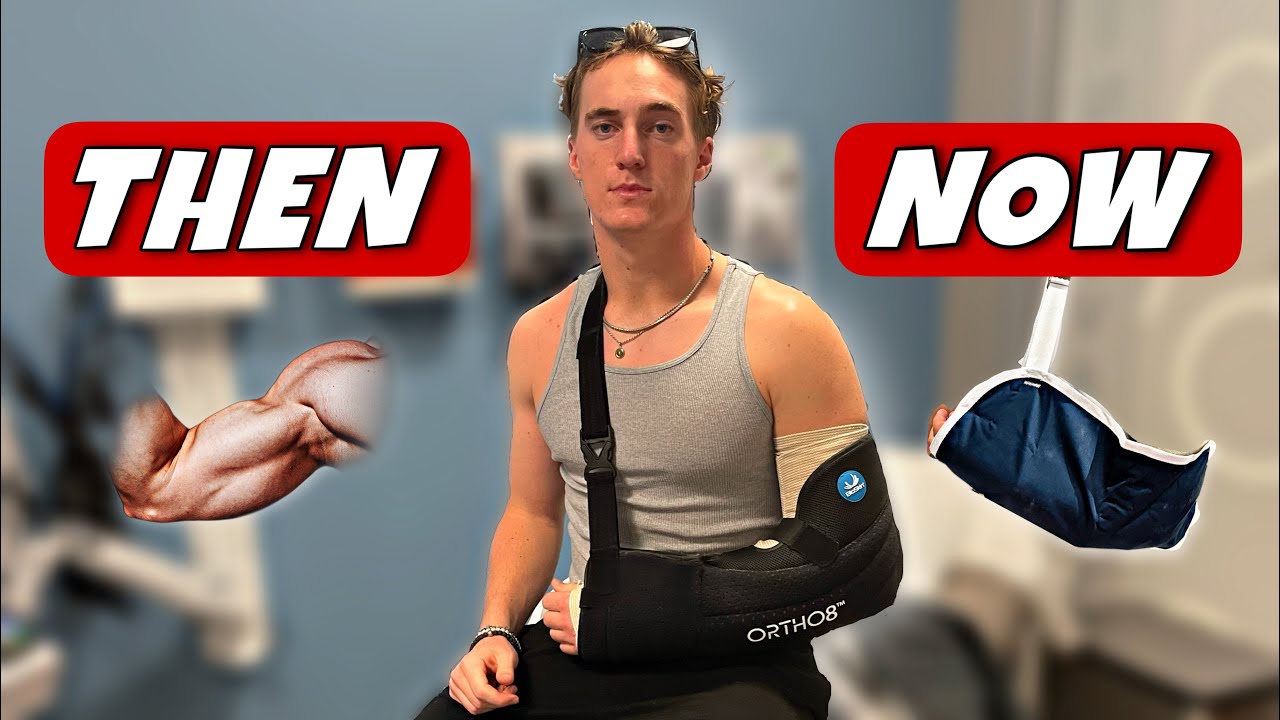 My Post TOMMY JOHN SURGERY Experience! - YouTube
