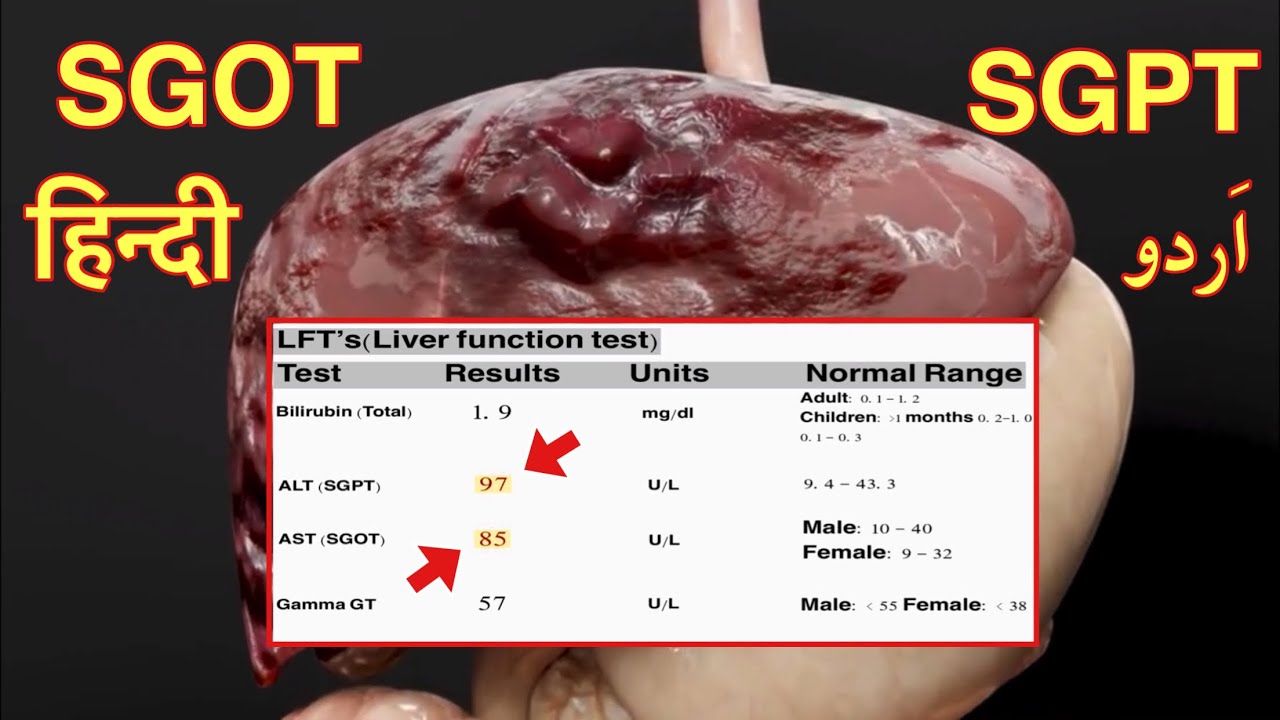 Sgot liver function test urdu/hindi | how to read liver function test ...