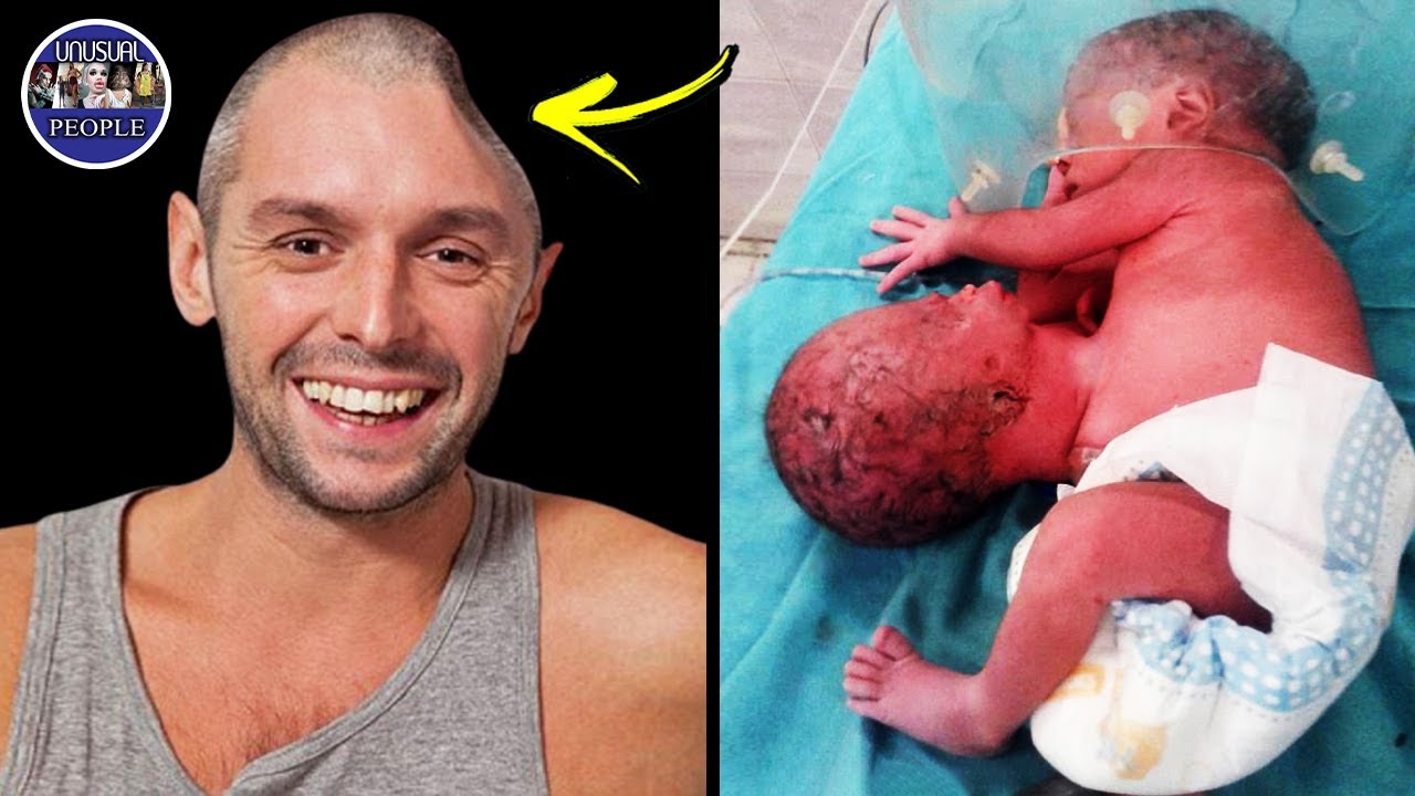 5 UNUSUAL PEOPLE IN THE WORLD PART 65 - YouTube