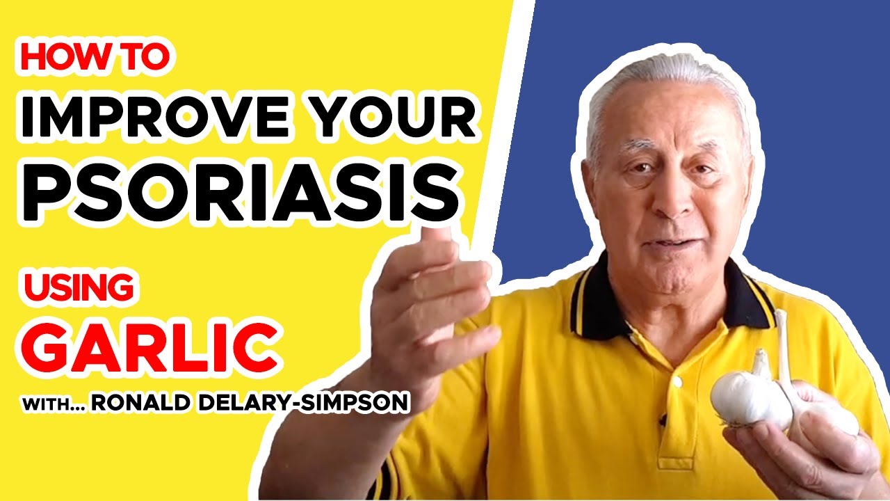 Garlic for Psoriasis - YouTube