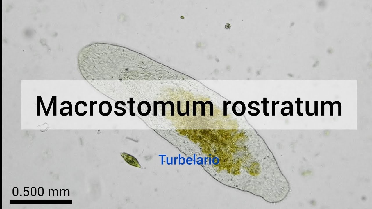 Macrostomum rostratum (Turbelario) - YouTube