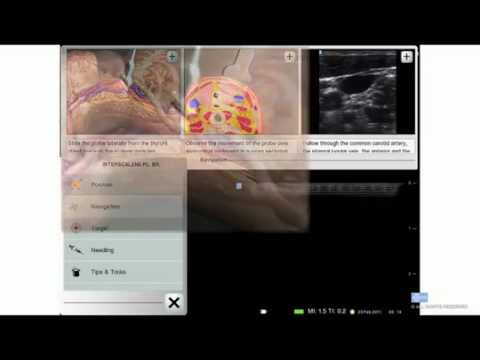 EZono 3000 - YouTube