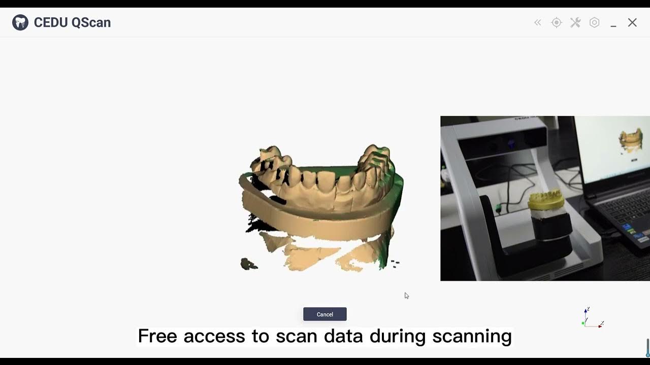 QSCAN/PRO Dental Scanner Cut Model Scan - YouTube