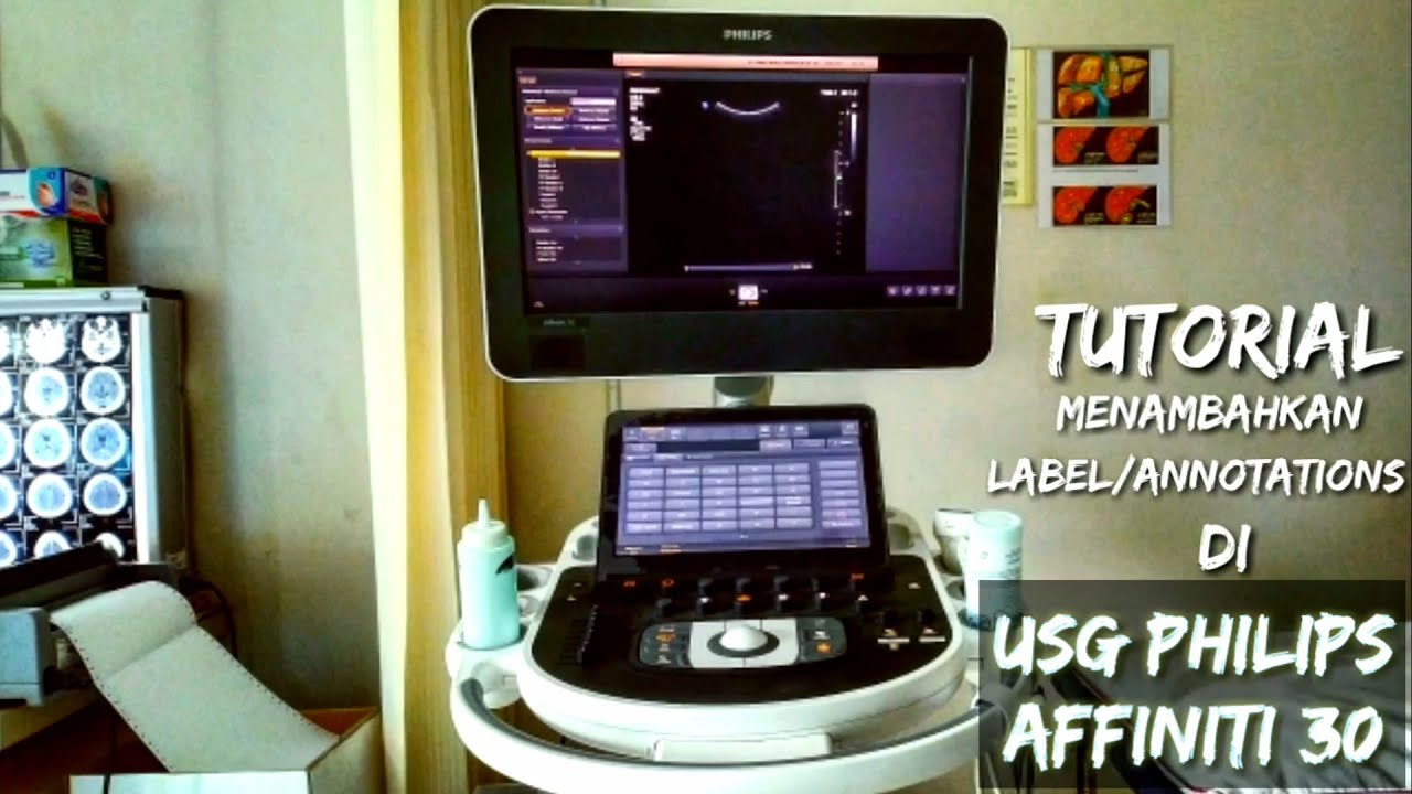 Tutorial menambahkan Label/Annotations di alat USG Philips Affiniti 30 ...