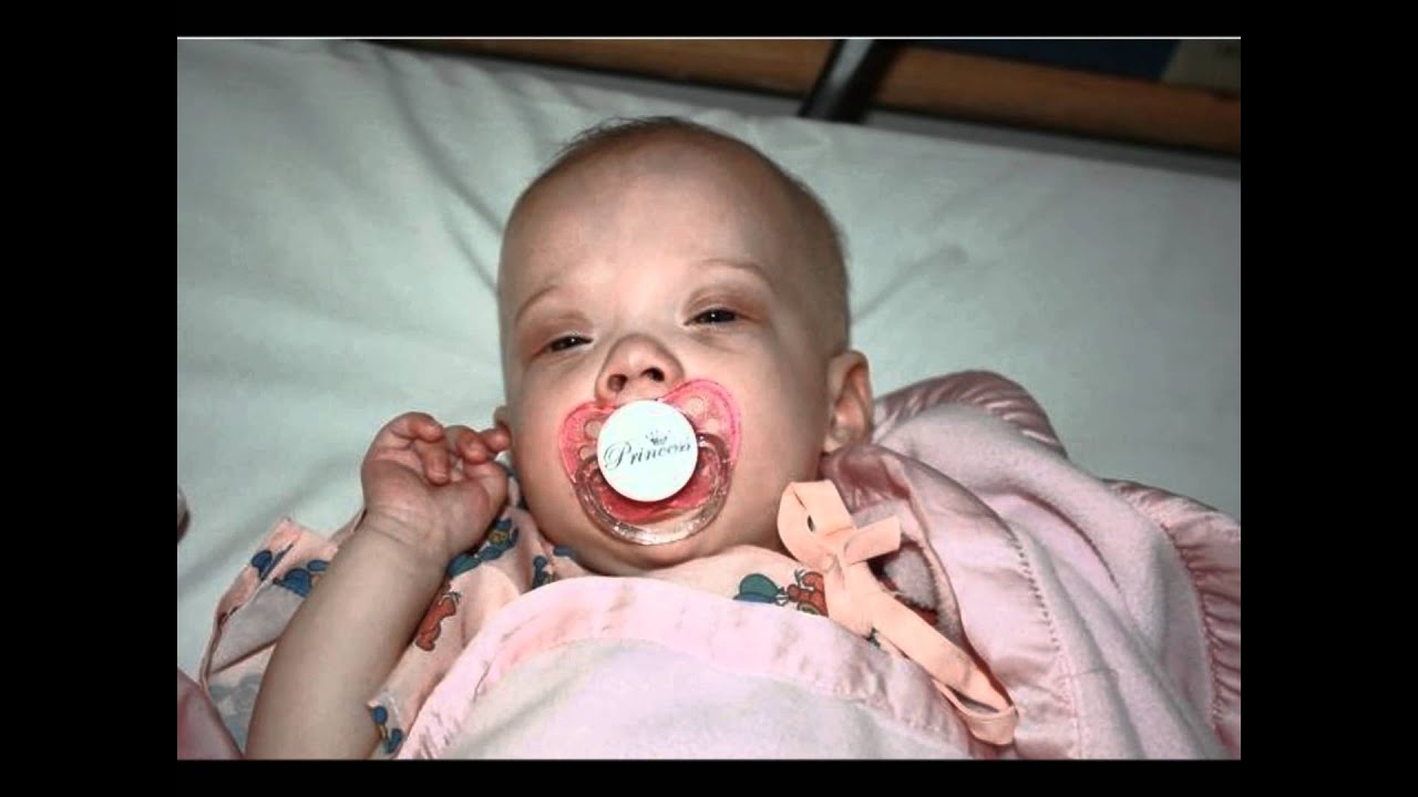 Kendall's Cancer and NF Story - YouTube