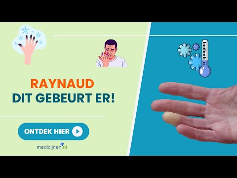Het fenomeen en de ziekte van Raynaud - YouTube