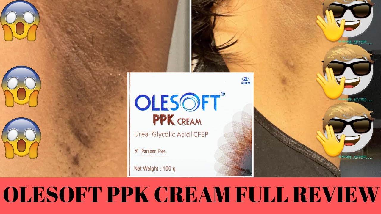 Olesoft PPK Cream Full Review: Unveiling Skin Radiance! | Olesoft PPK ...