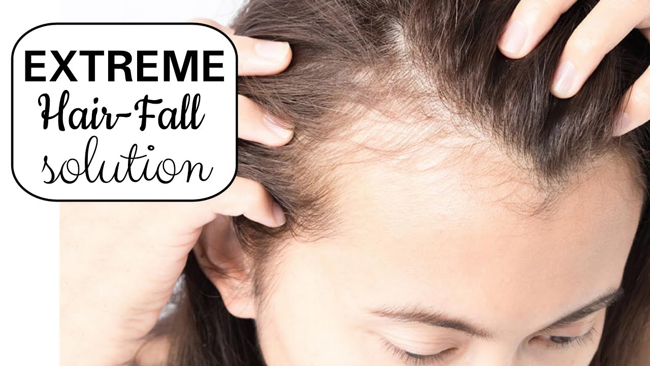 How to STOP Extreme Hair Fall - YouTube
