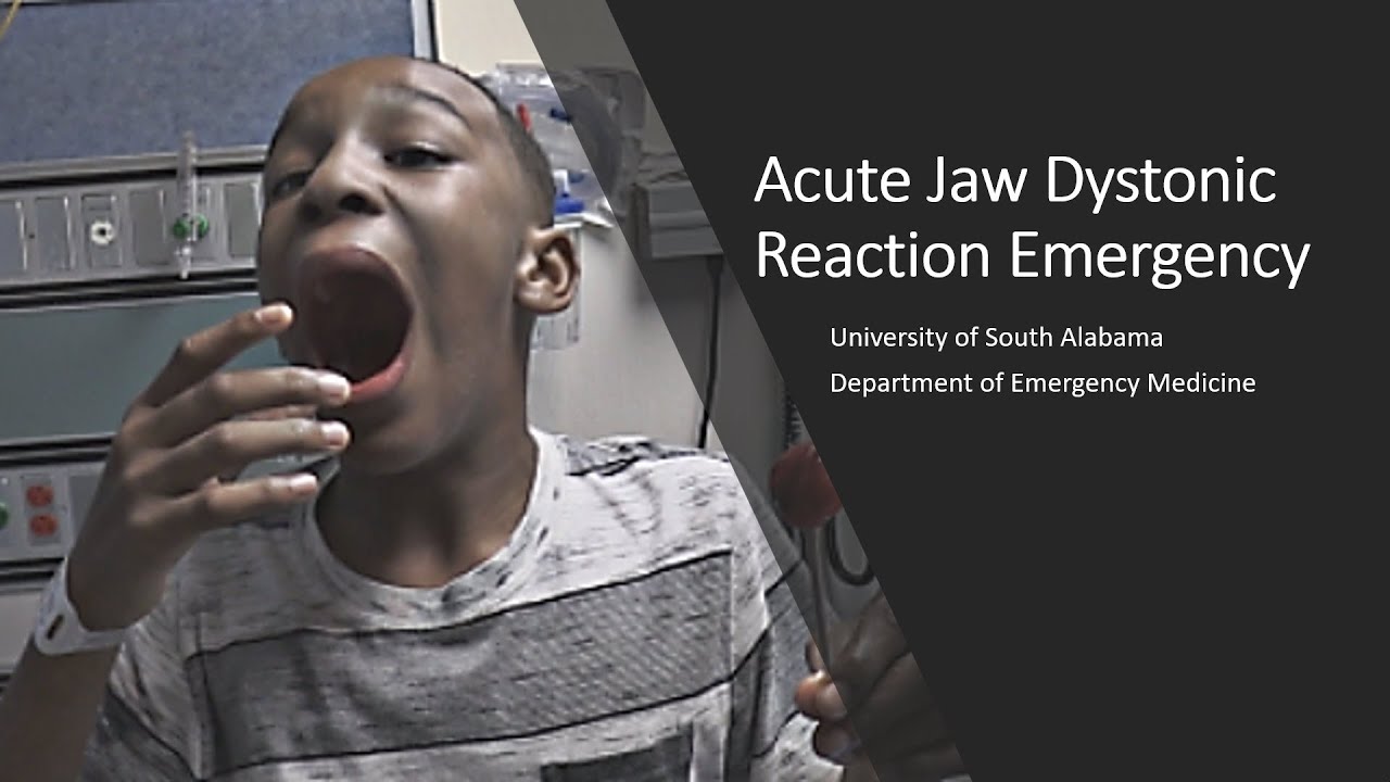 Acute Dystonia Drugs And Toxic Agents That May Cause Dystonia In