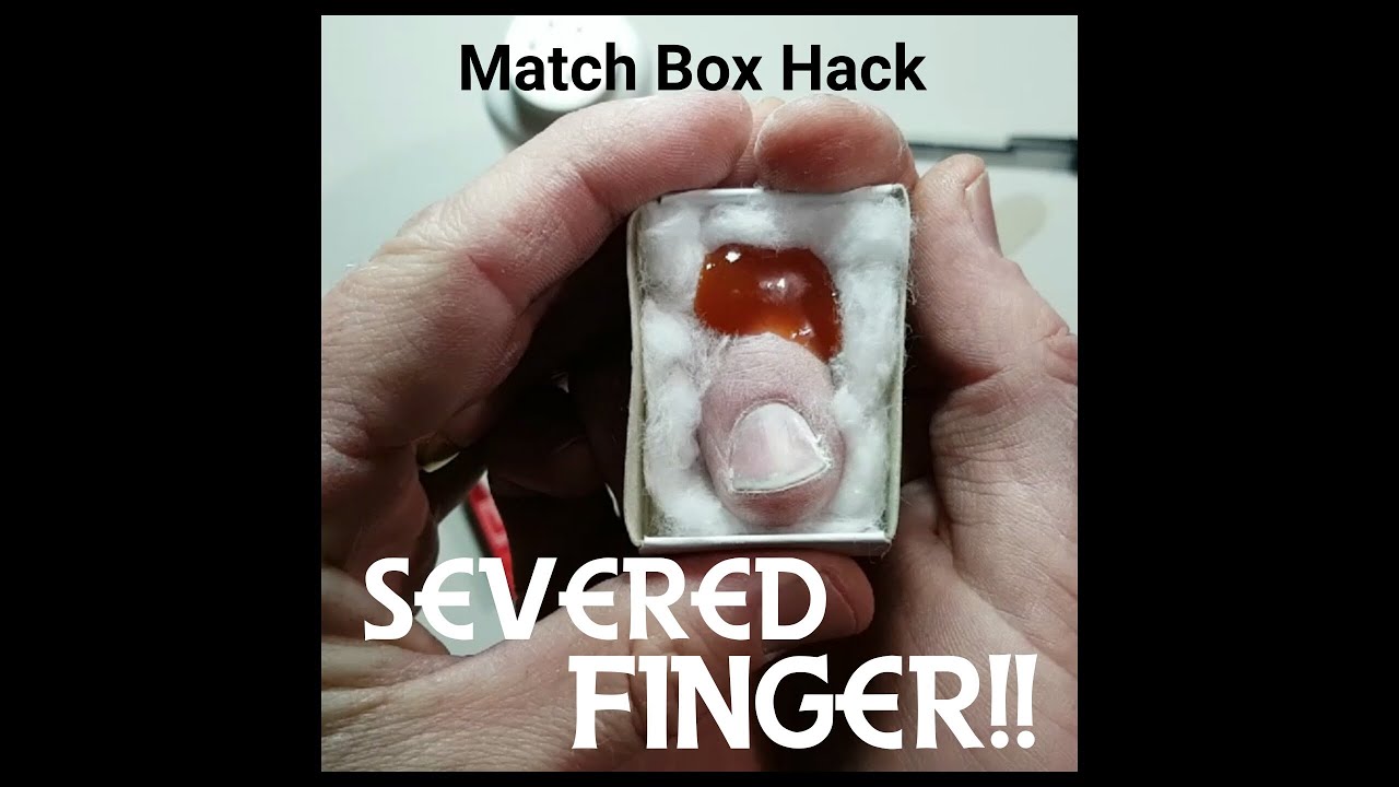Severed Finger in a Box! Matchbox hacks - YouTube