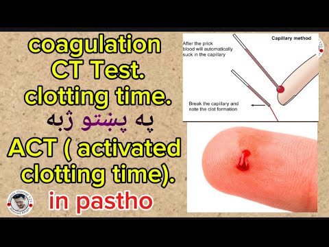 CT test/clotting time /ACT ( activated clotting time) coagulation ...