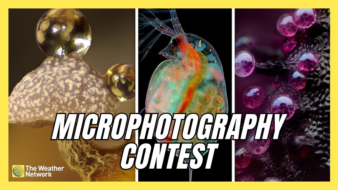 Stunning Microphotography Contest Reveals the World Within Our World ...
