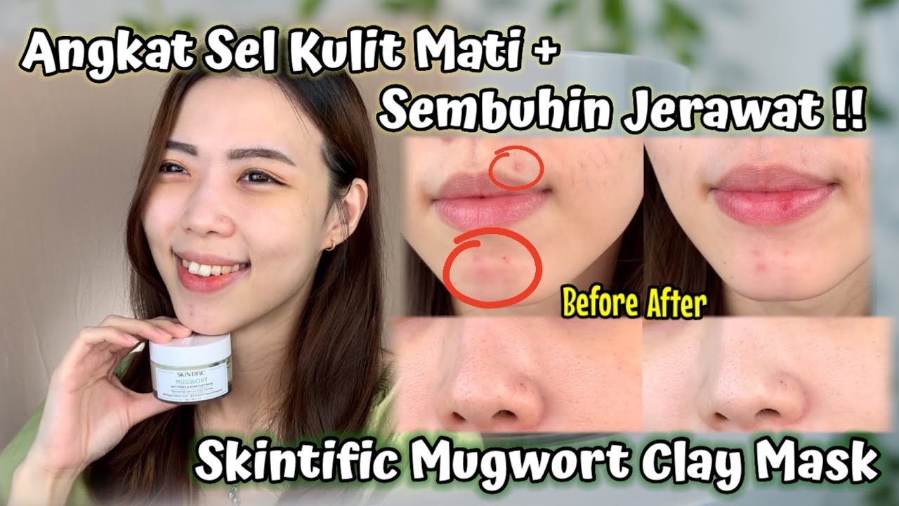 Eksfoliasi Untuk Kulit Berjerawat Jangan Salah Pilih Produk