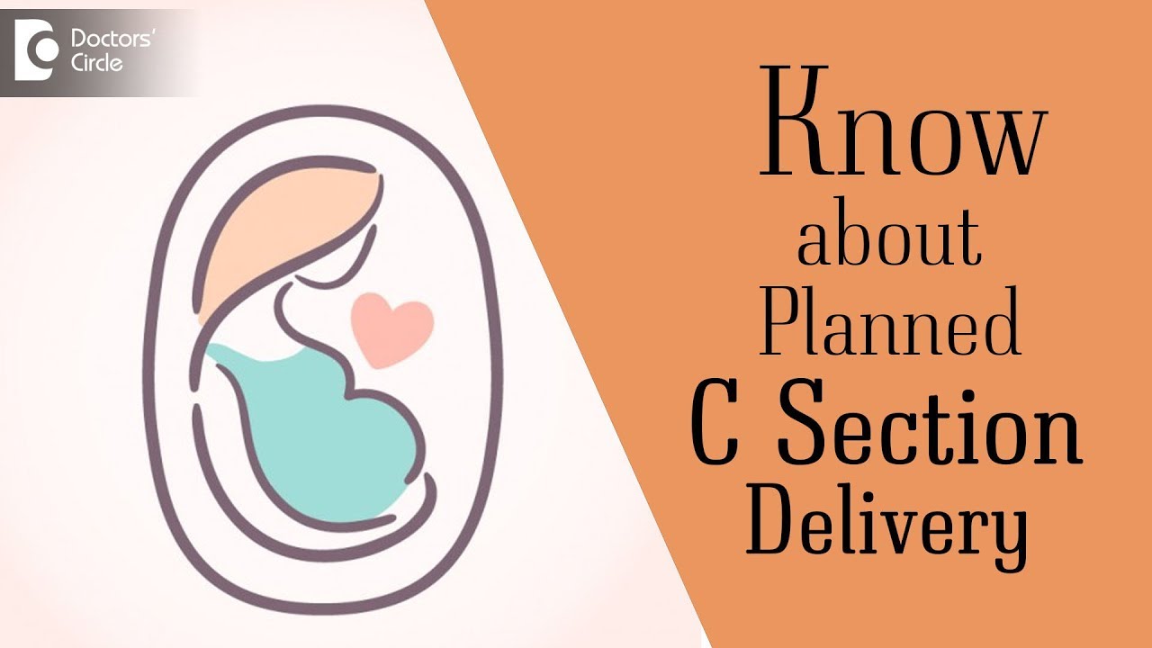 What do you mean by a planned C section? - Dr. Mangala Devi KR - YouTube