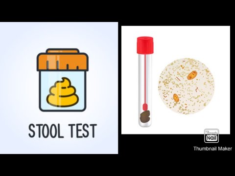 Stool R/E Test Complete procedure. - YouTube