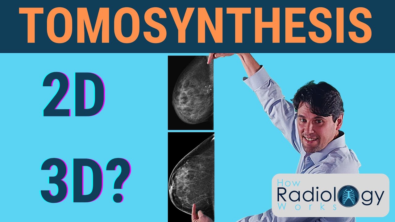 Tomosynthesis Does It Offer 3d Mammography Youtube
