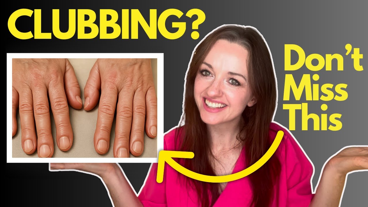 How to Examine for Finger Clubbing (And Actually Remember the Causes ...