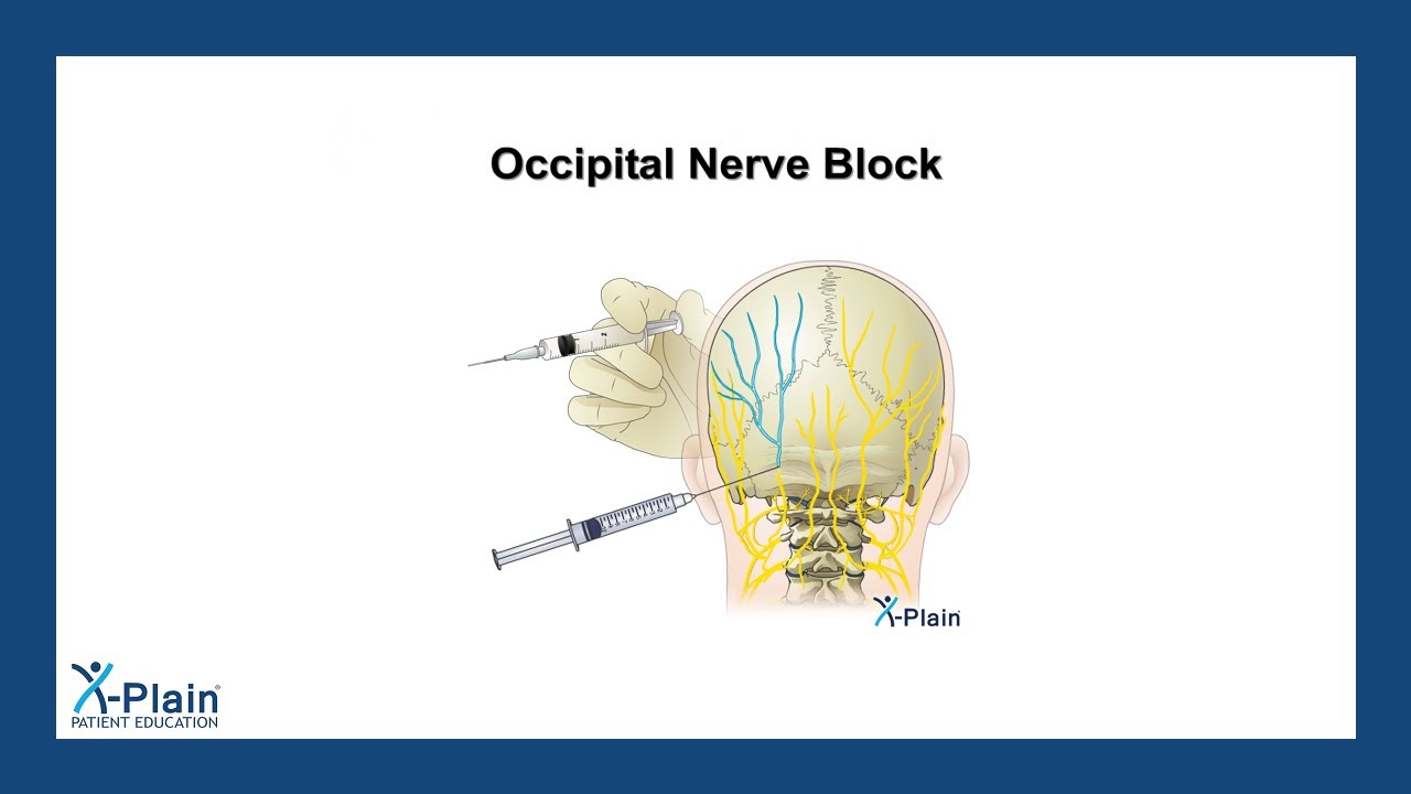 Occipital Nerve Block - YouTube