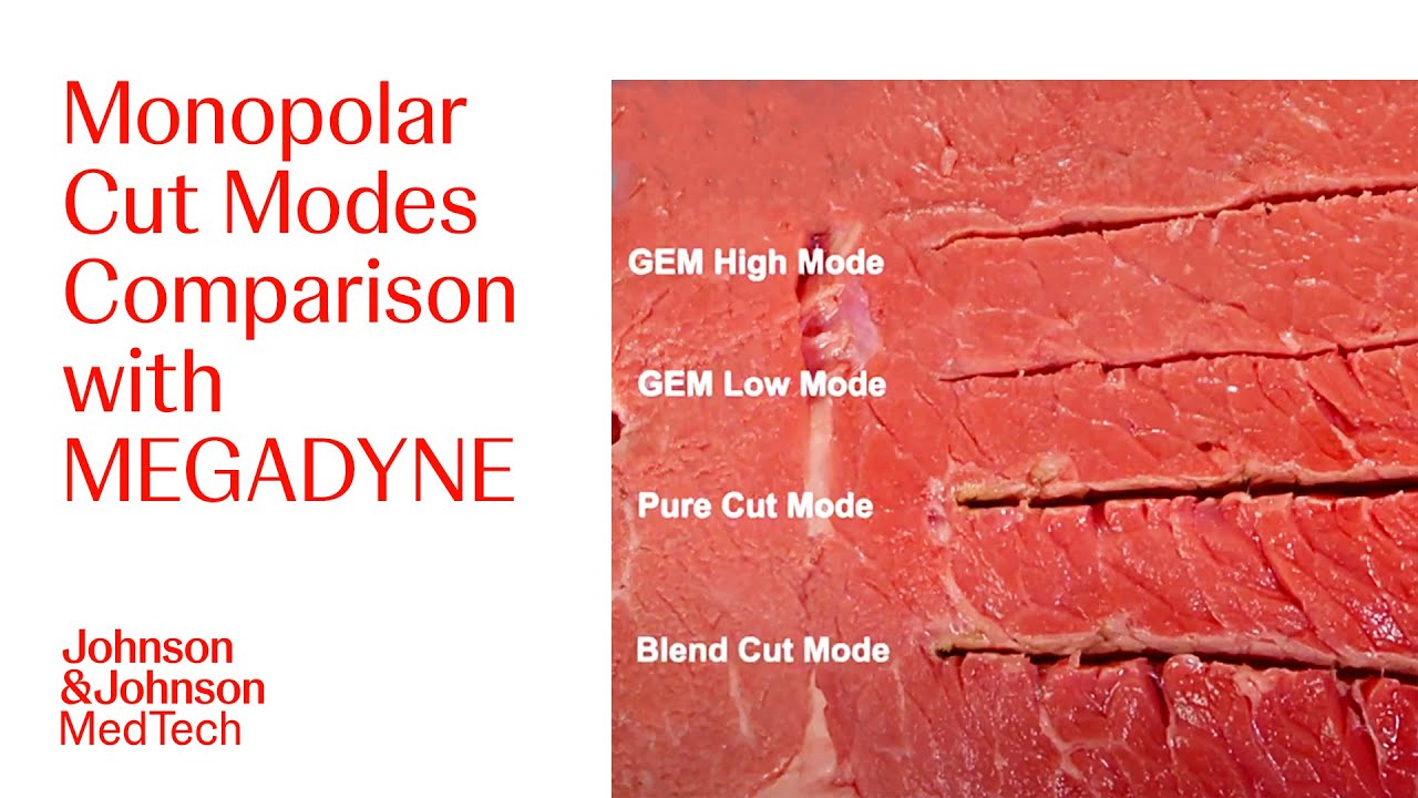 Comparing Monopolar Cut Modes using MEGADYNE Electrosurgical Generator ...