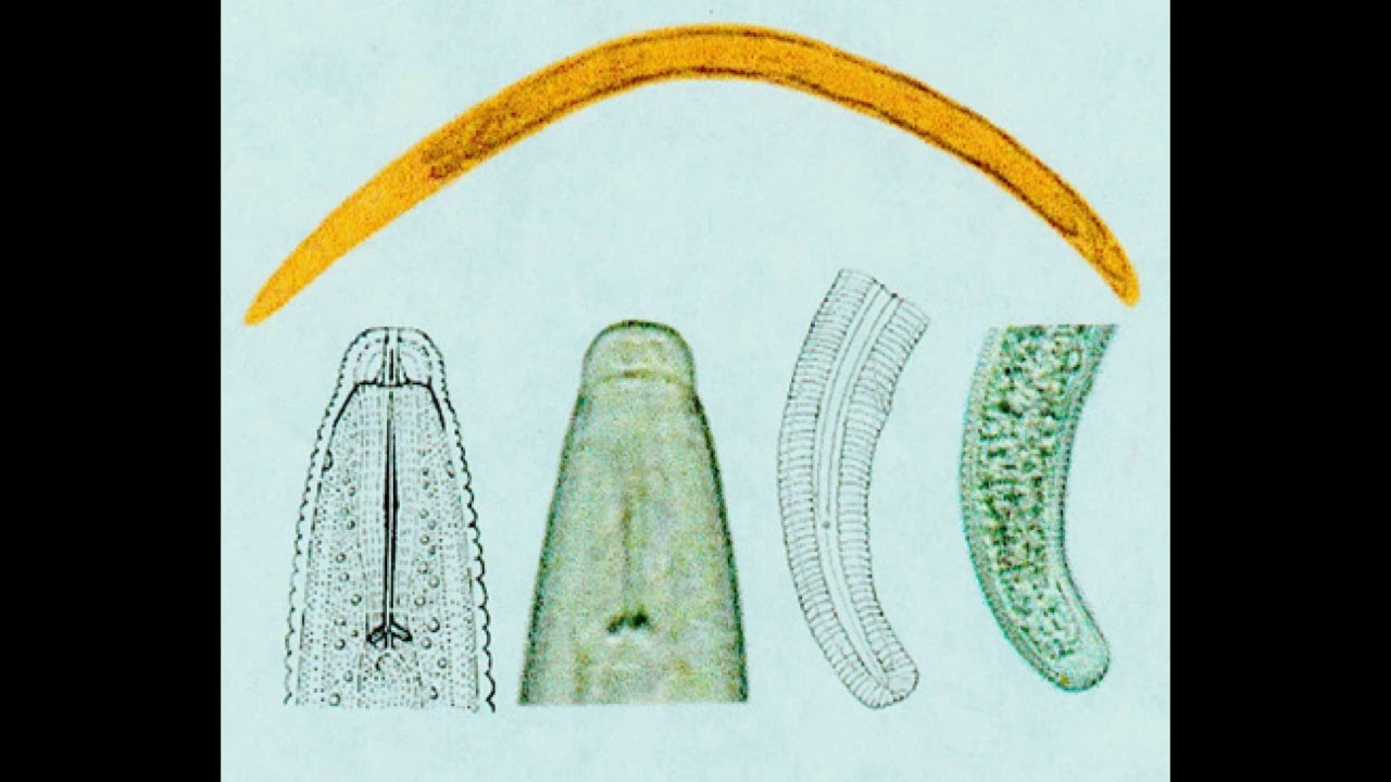 PRATYLENCHUS SPP - YouTube