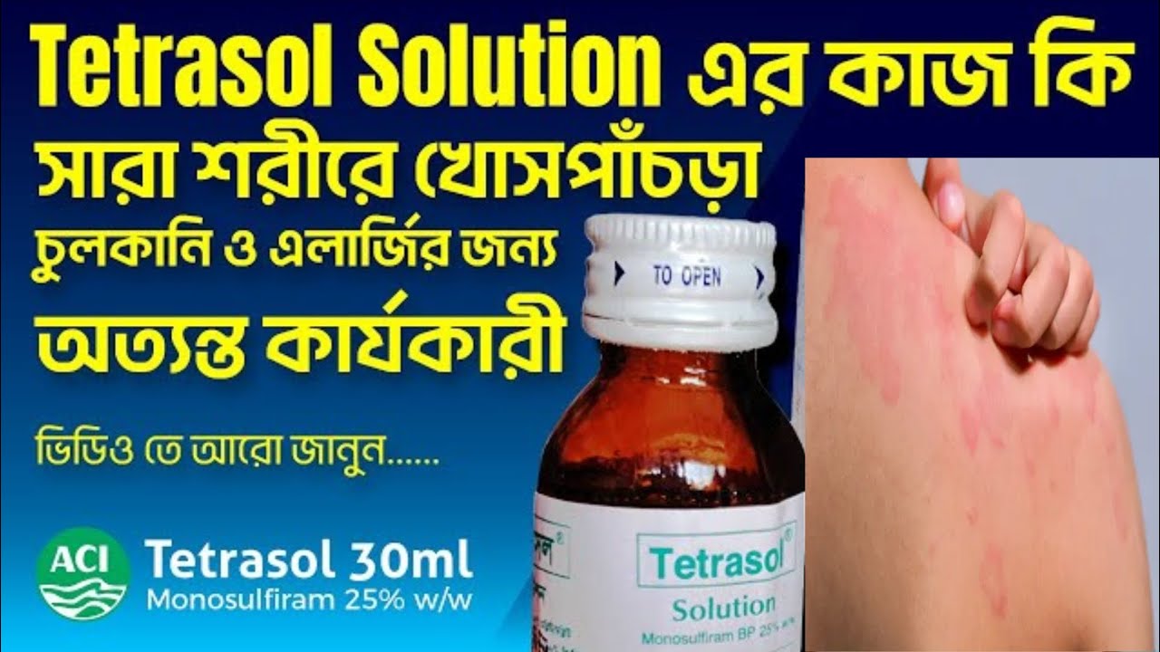 Tetrasol Solution এর কাজ কি | সঠিক নিয়মে ব্যবহার। শরীরে খোস... - YouTube