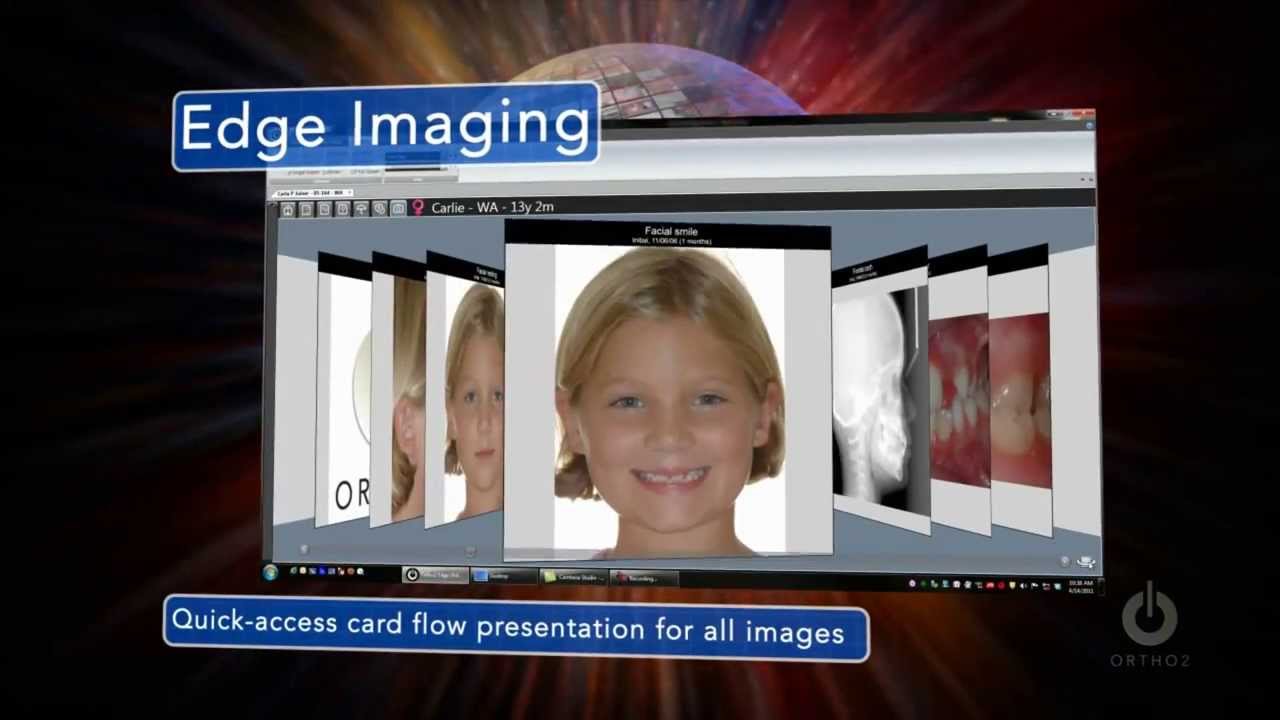 Edge Animations and Edge Imaging Preview - YouTube