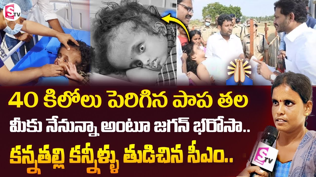 AP CM Jagan Help to Child and Saves Child Life | YS Jagan Shows his ...