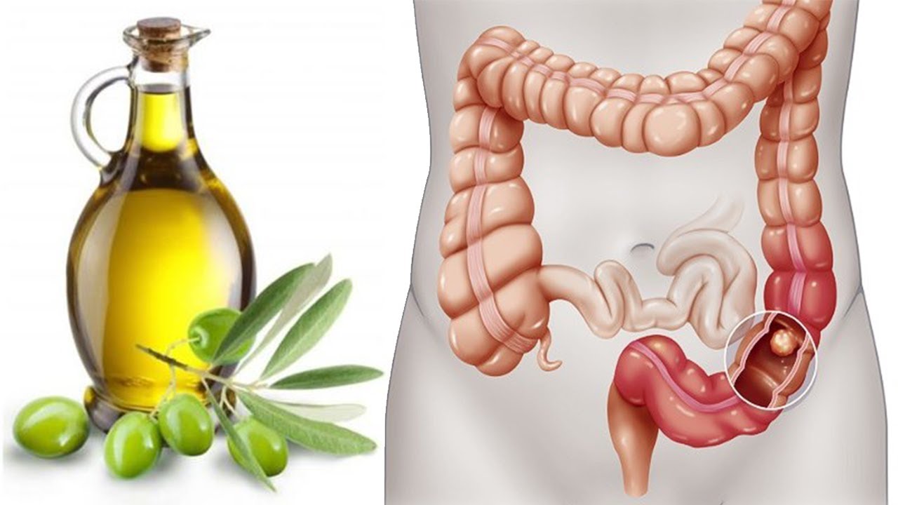 Keni probleme me zorrët? Mjekja e njohur zbulon ila'çin që do ju ...