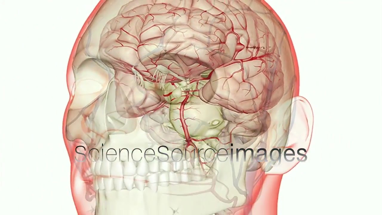 Cerebral Aneurysm, 3D Animation of the Brain - YouTube