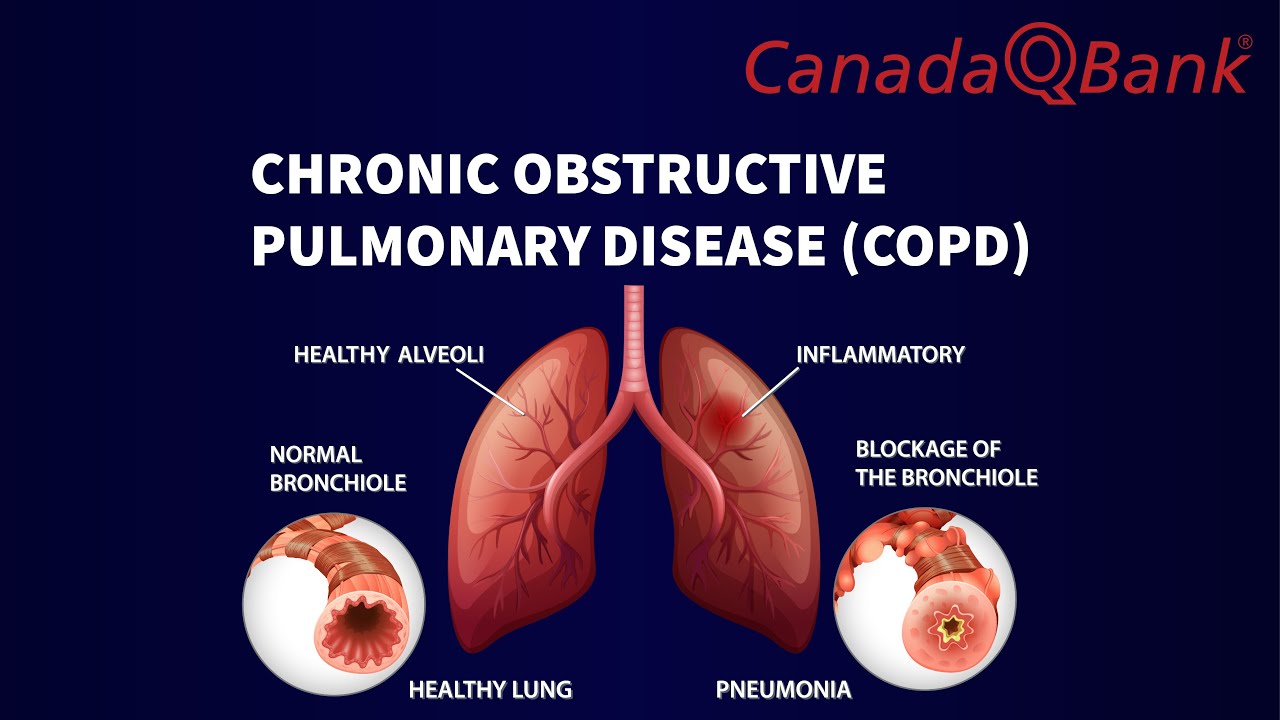 Chronic Obstructive Pulmonary Disease (COPD) - YouTube