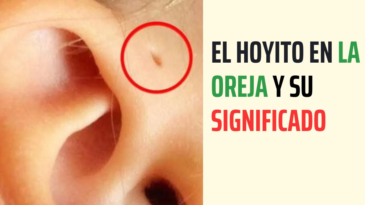 El SIGNIFICADO de tener un HOYITO EN LA OREJA - YouTube