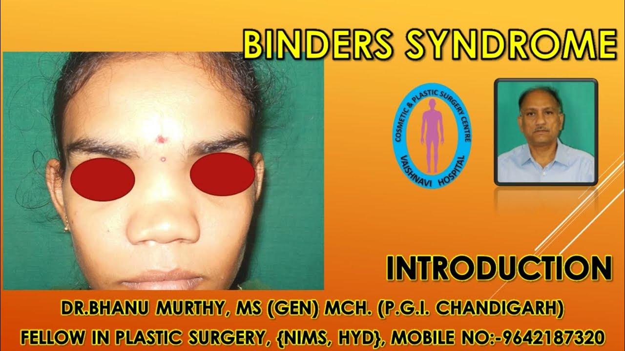 Binders Syndrome | DR.M. BHANUMURTHY | VAISHNAVI SUPER SPECIALITY HOSPITAL - YouTube